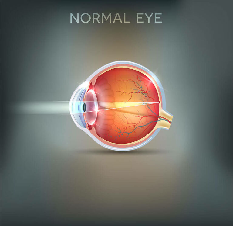 normal_eye - Anaheim Eye Institute