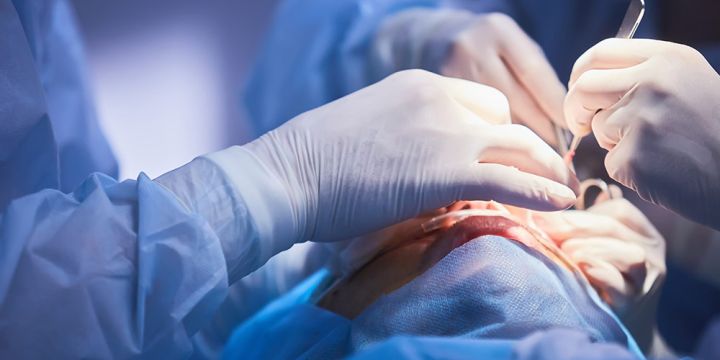 What is the difference between Laser Cataract Surgery and basic Manual ...