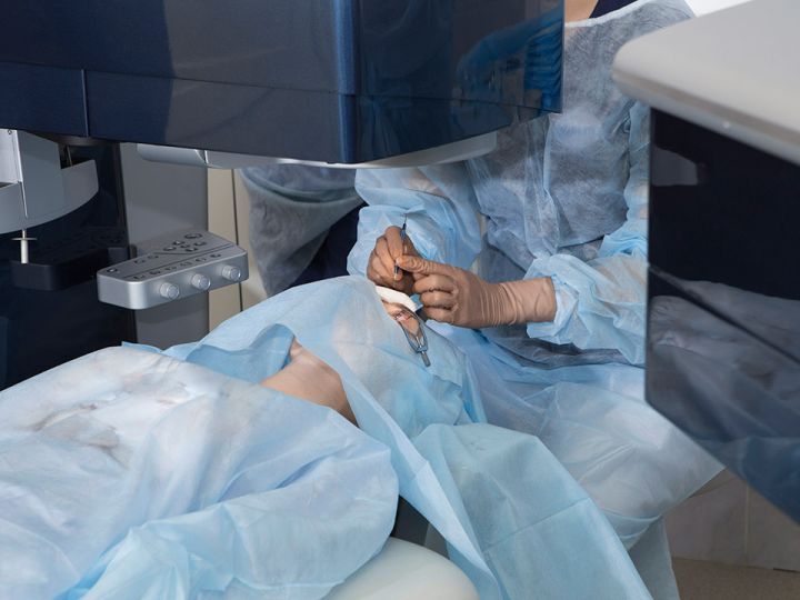 Strabismus Surgery - Anaheim Eye Institute