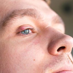 Why Do My Contacts Hurt? 6 Possible Reasons - Anaheim Eye Institute